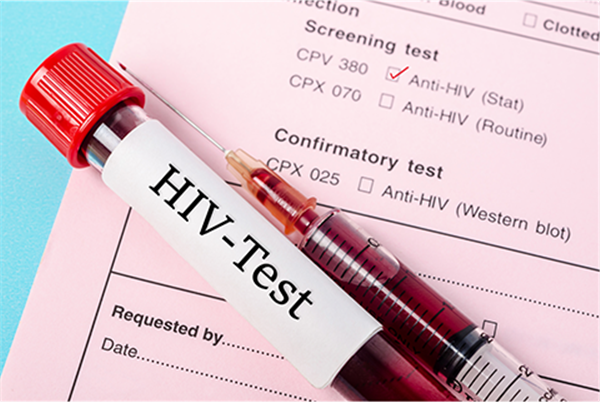 Health Department receives High-Impact HIV Prevention Program grant ...